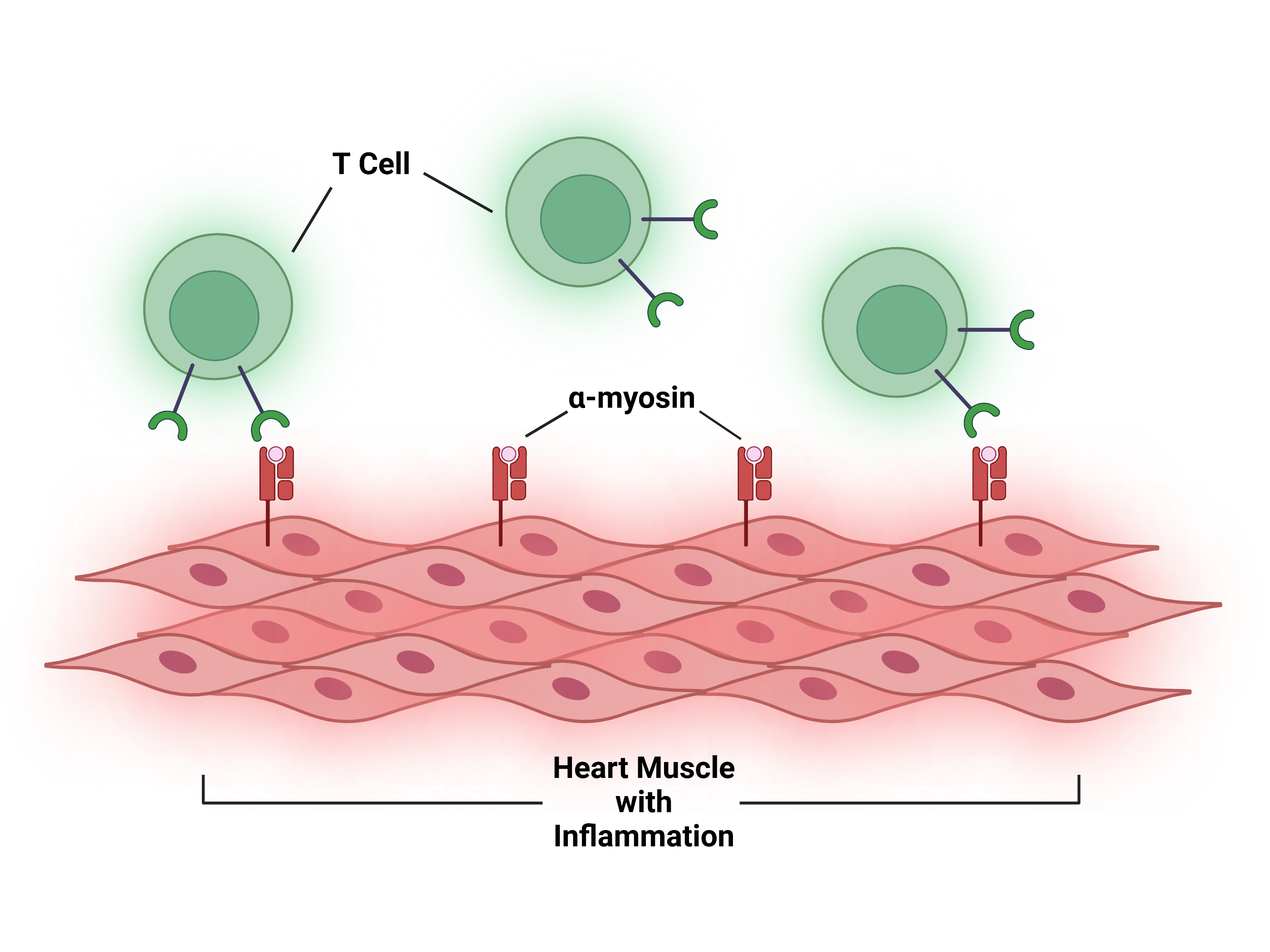 What Causes Immunotherapy’s Heart-Related Side Effects? - NCI